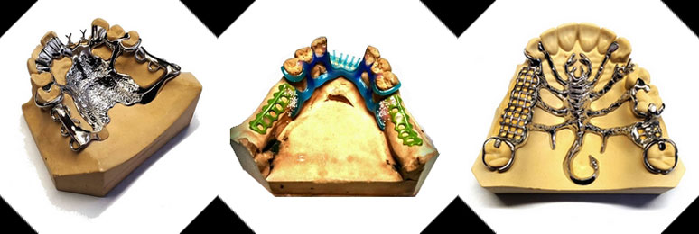 Châssis métallique stellite dentaire sous traitance