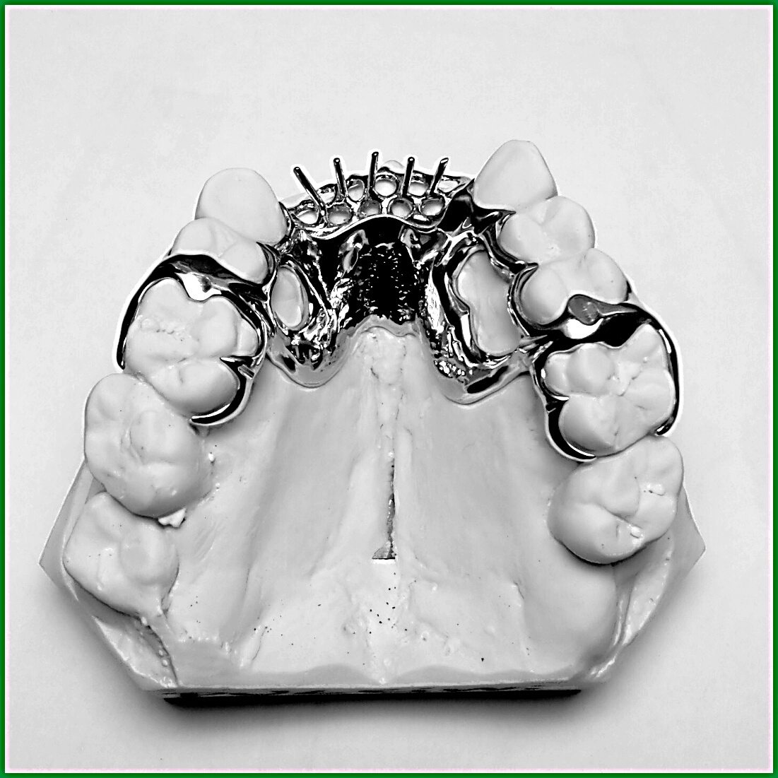 Châssis métallique (stellite) dentaire | Laboratoire Simon N