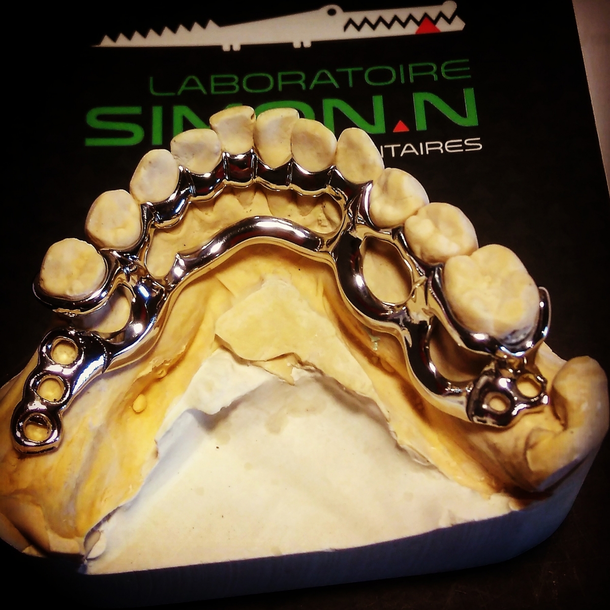 Châssis métallique (stellite) dentaire | Laboratoire Simon N