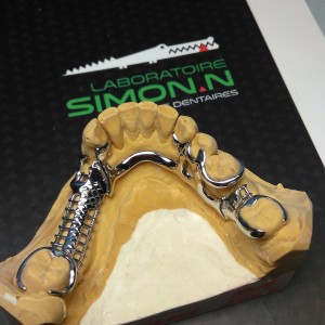 Châssis métallique (stellite) dentaire | Laboratoire Simon N