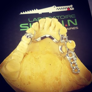 Châssis métallique (stellite) dentaire | Laboratoire Simon N